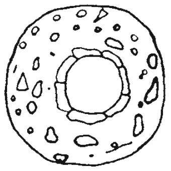 Cyclopyxis overview 2 – Microworld