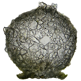 Difflugia key spherical – Microworld