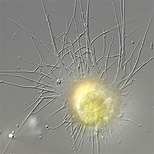 Vermamoeba vermiformis – Microworld